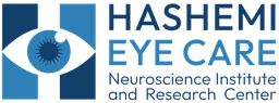 Laser Iridotomy (LPI): Procedure for Angle-Closure Glaucoma | Hashemi ...